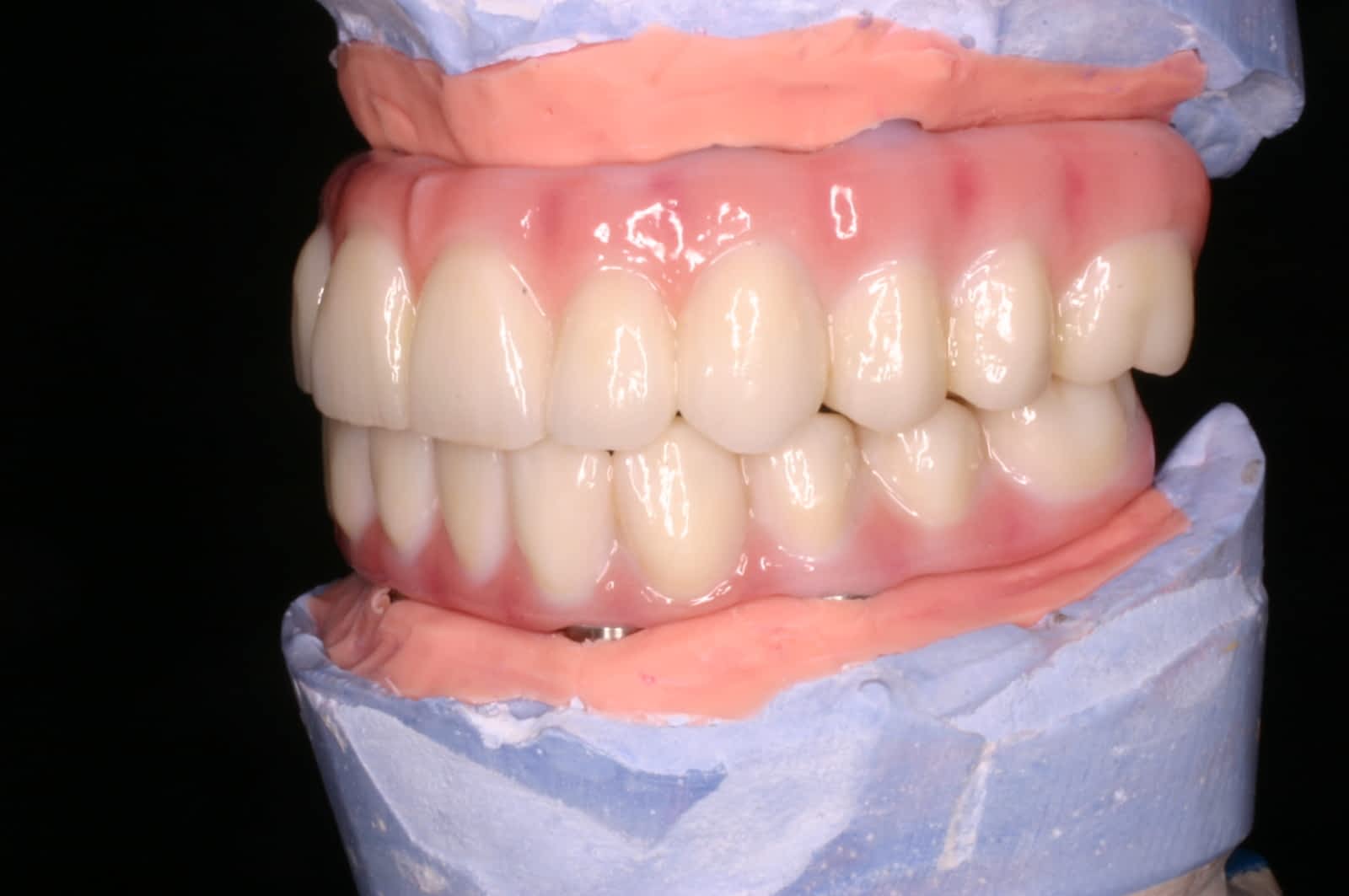 Complete Dentures - My website